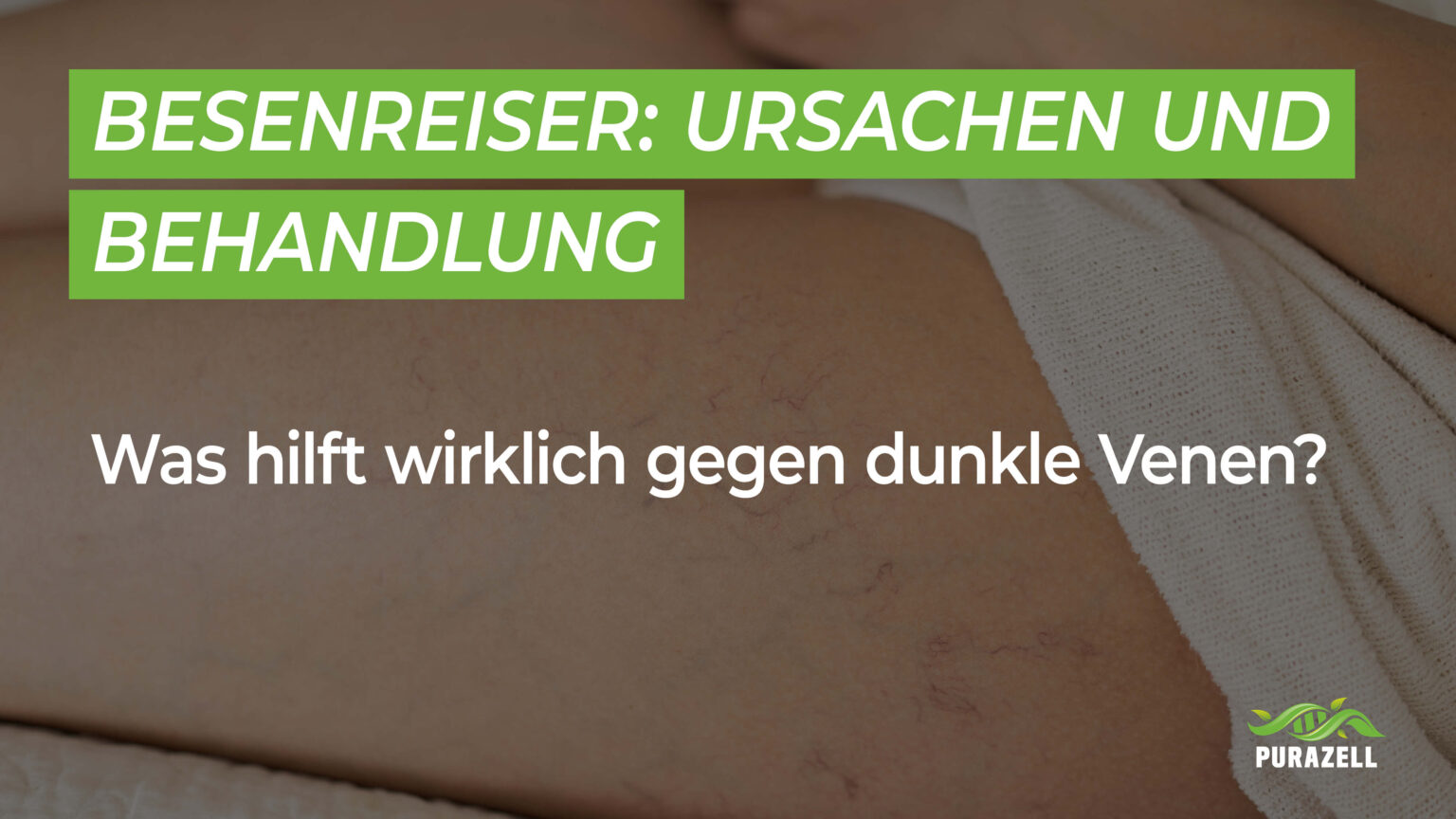 Woher kommen Besenreiser: Ursachen, Gefahren & Behandlung